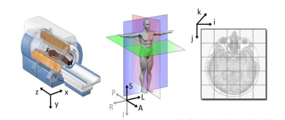 LPS和RAS坐标系_lps坐标-CSDN博客