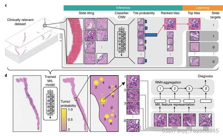 （WSI分类）WSI分类文献小综述_scaling vision transformers to gigapixel images vi-CSDN博客