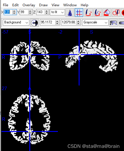 核磁共振常用的文件格式介绍：NIfTI volume 格式 (*.nii)， GIFTI 格式 (*.gii)， CIFTI 格式 (*.nii)-CSDN博客
