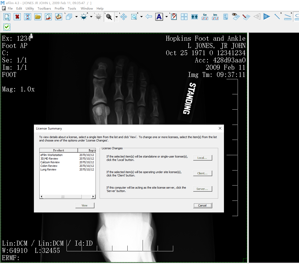eFilm Workstation dicom 4.3 vs radiant dicom-CSDN博客