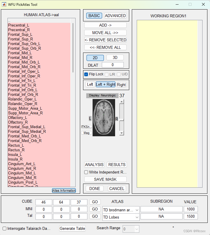制作指定脑区的maks(包括重采样)_wfu pickatlas-CSDN博客