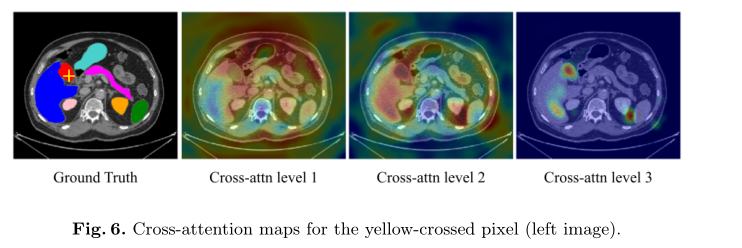 [Transformer]U-Net Transformer: Self and Cross Attention for Medical Image Segmentation_u ...