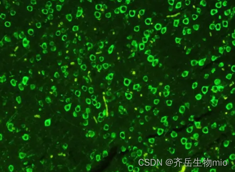 FITC-Lysozyme 荧光素标记溶菌酶，CY3、CY5、CY5.5、CY7、CY7.5、ICG标记溶菌酶/Lysozyme_溶菌酶 荧光 ...
