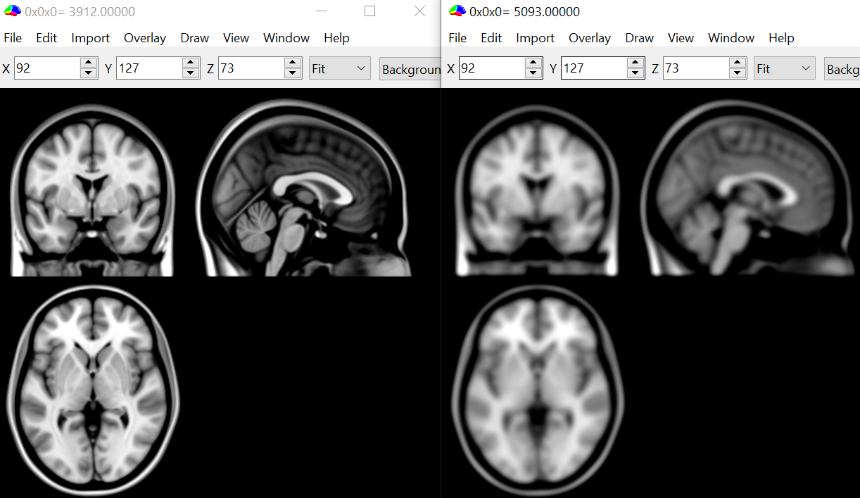 MRI脑影像分析——多种工具实现Nifti(*.nii)文件读取、处理与写入——把小舞写进脑海里、6mm半高全宽高斯核平滑脑影像、NIFTI ...
