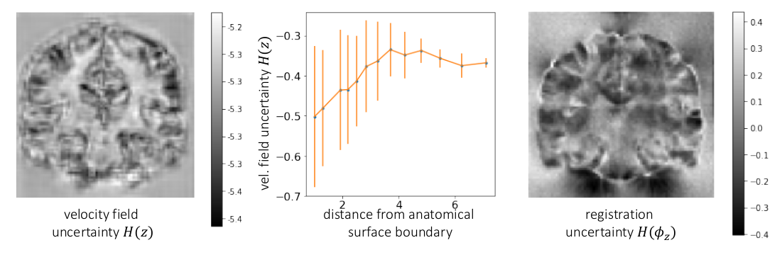 【学习笔记VoxelMorph系列文章2】：《Unsupervised Learning for Fast Probabilistic Diffeomorphic Registration ...