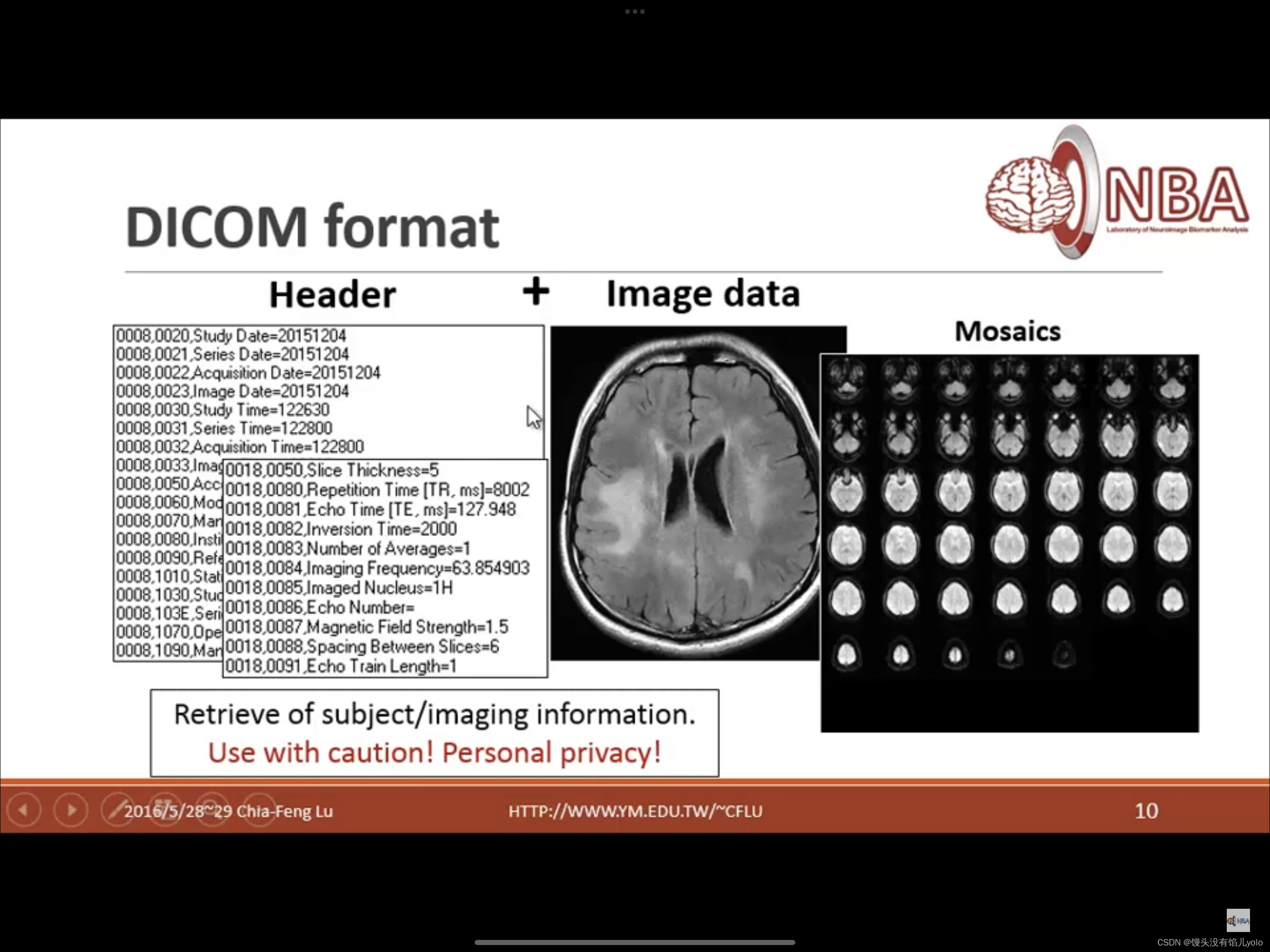 卢家峰课程系列-- advanced rs-fmri analysis 1/6 基本介绍与DICOM_ima文件如何转dicom-CSDN博客