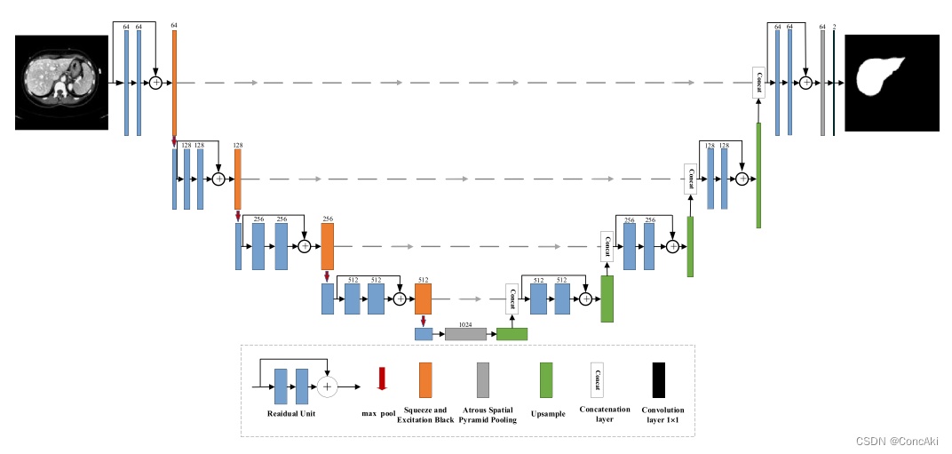 Sar U Net Squeeze And Excitation Block And Atrous Spatial Pyramidpooling Based Residual U Net