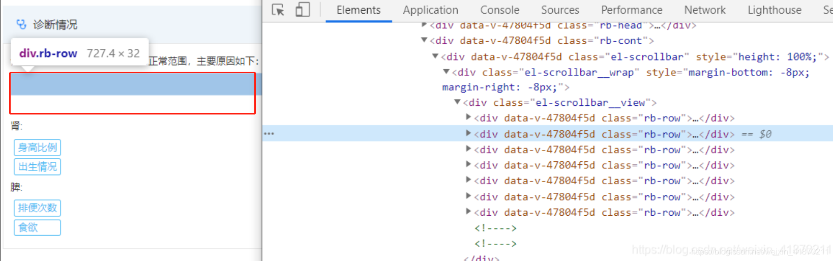 Vue uses computed to implement the contents of each object in an array ...
