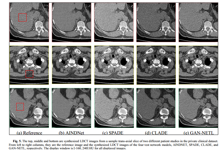 Low-dose CT Image Synthesis for Domain Adaptation Imaging Using a Generative Adversarial Network ...