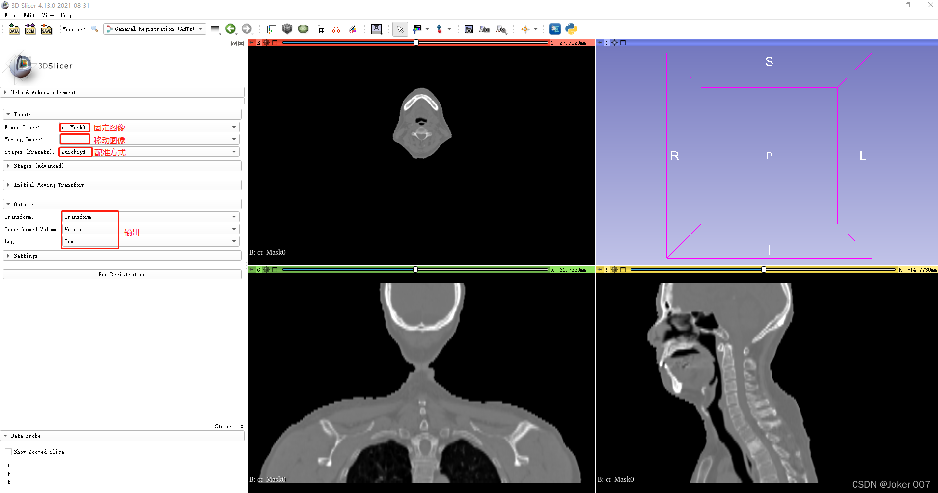 3d Slicer——配准篇基于ants工具详细教程ants配准 Csdn博客
