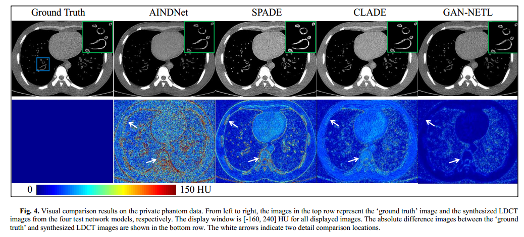 Low-dose CT Image Synthesis for Domain Adaptation Imaging Using a ...