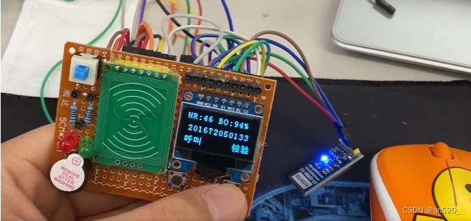 毕业设计| STM32版RFID医嘱专用手环 【评论区领取项目资料包】_心率血氧max30102工作流程图-CSDN博客