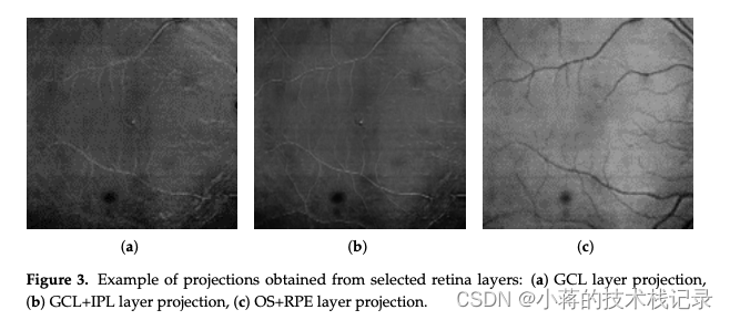 Neural Networks Application for Accurate Retina Vessel Segmentation ...