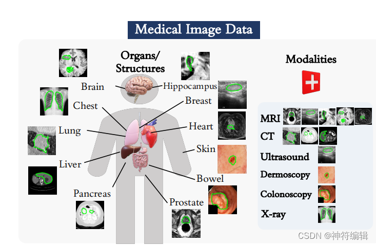 SAM在医学图像分割任务的精度分析（2023+Accuracy of Segment-Anything Model (SAM ...