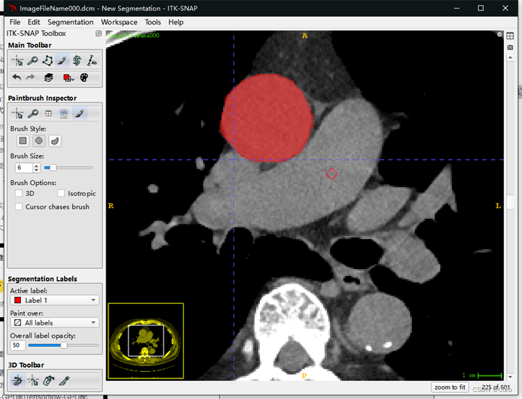 ITK-snap医学图像标注方法（超级详细）——保姆级_itk snap-CSDN博客