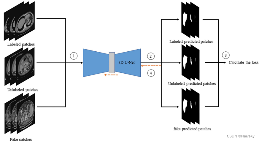 论文笔记Three-Dimensional Liver Image Segmentation Using Generative ...