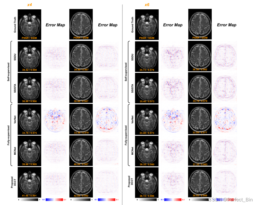 DSFormer: A Dual-domain Self-supervised Transformer for acc Multi-contrast MRI Re---文章阅读记录-CSDN博客