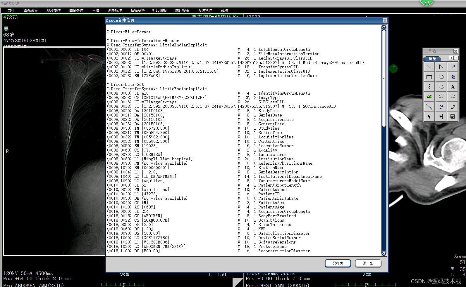 医院PACS系统 三维重建技术认识_3d可视化 pacs-CSDN博客