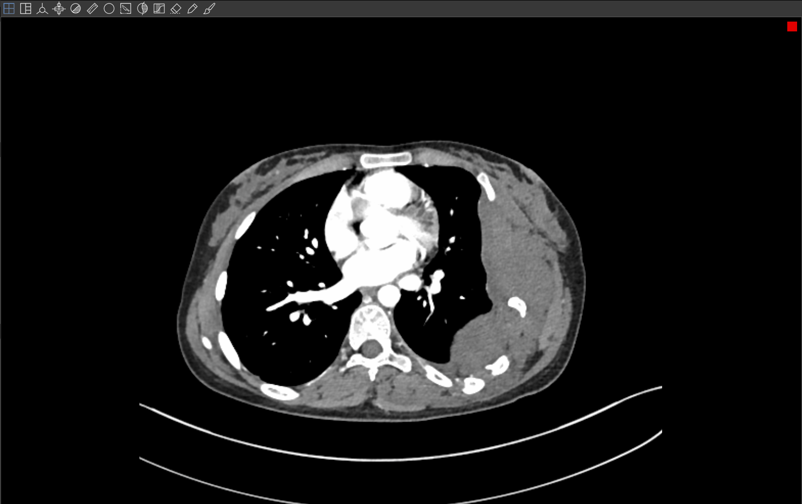 VTK感兴趣勾画 方式二： vtkTexture实现_wpf vtk 不规则obj添加texture-CSDN博客