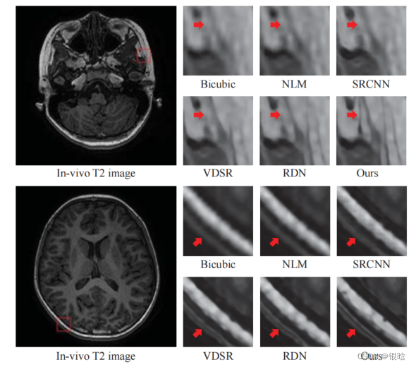 医疗图像论文学习_dodnet-CSDN博客