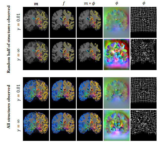【学习笔记】VoxelMorph 进行的实验与总结_voxelmorgh-CSDN博客