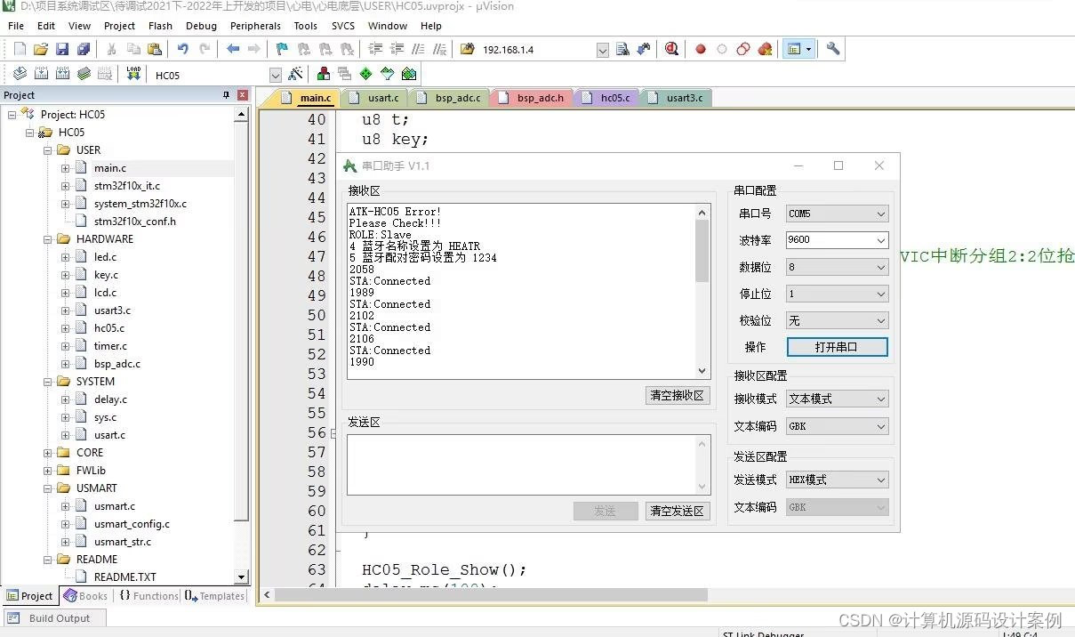 基于stm32心电图监测蓝牙传输app设计 单片机毕业源码设计stm32 蓝牙 与手机app 传递参数 Csdn博客 