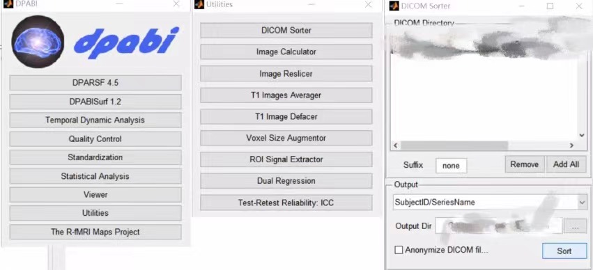 fMRI原始数据分割的笔记_fmri dicom sort-CSDN博客