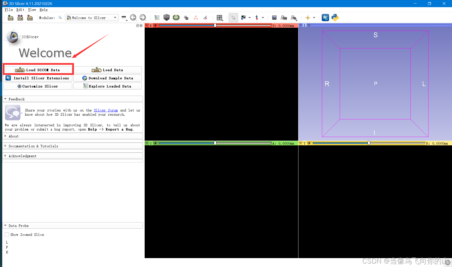 3DSlicer三维重建-CSDN博客