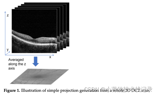 Neural Networks Application for Accurate Retina Vessel Segmentation ...