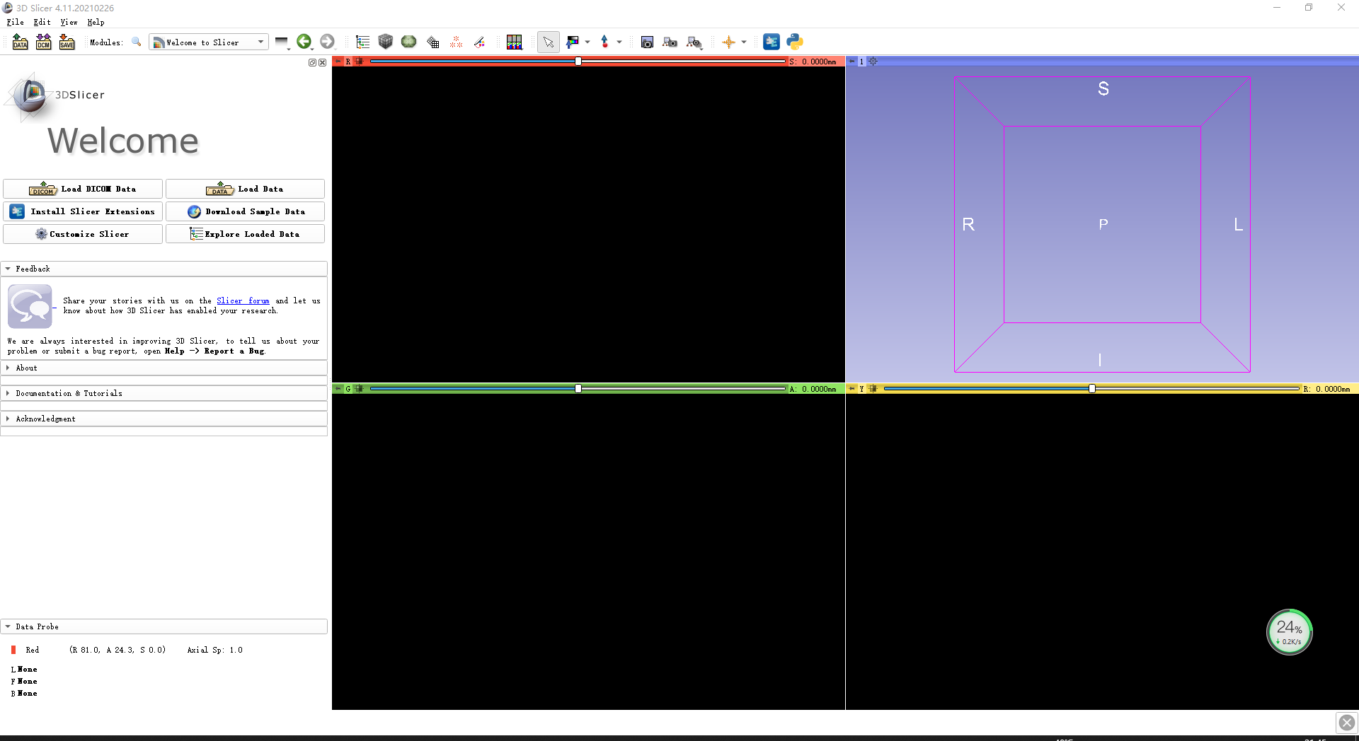 Slicer学习笔记（十七）编写一个python扩展模块_3d slicer自定义扩展-CSDN博客
