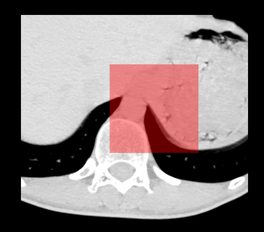 VTK感兴趣勾画 方式一： vtkImageMask实现-CSDN博客