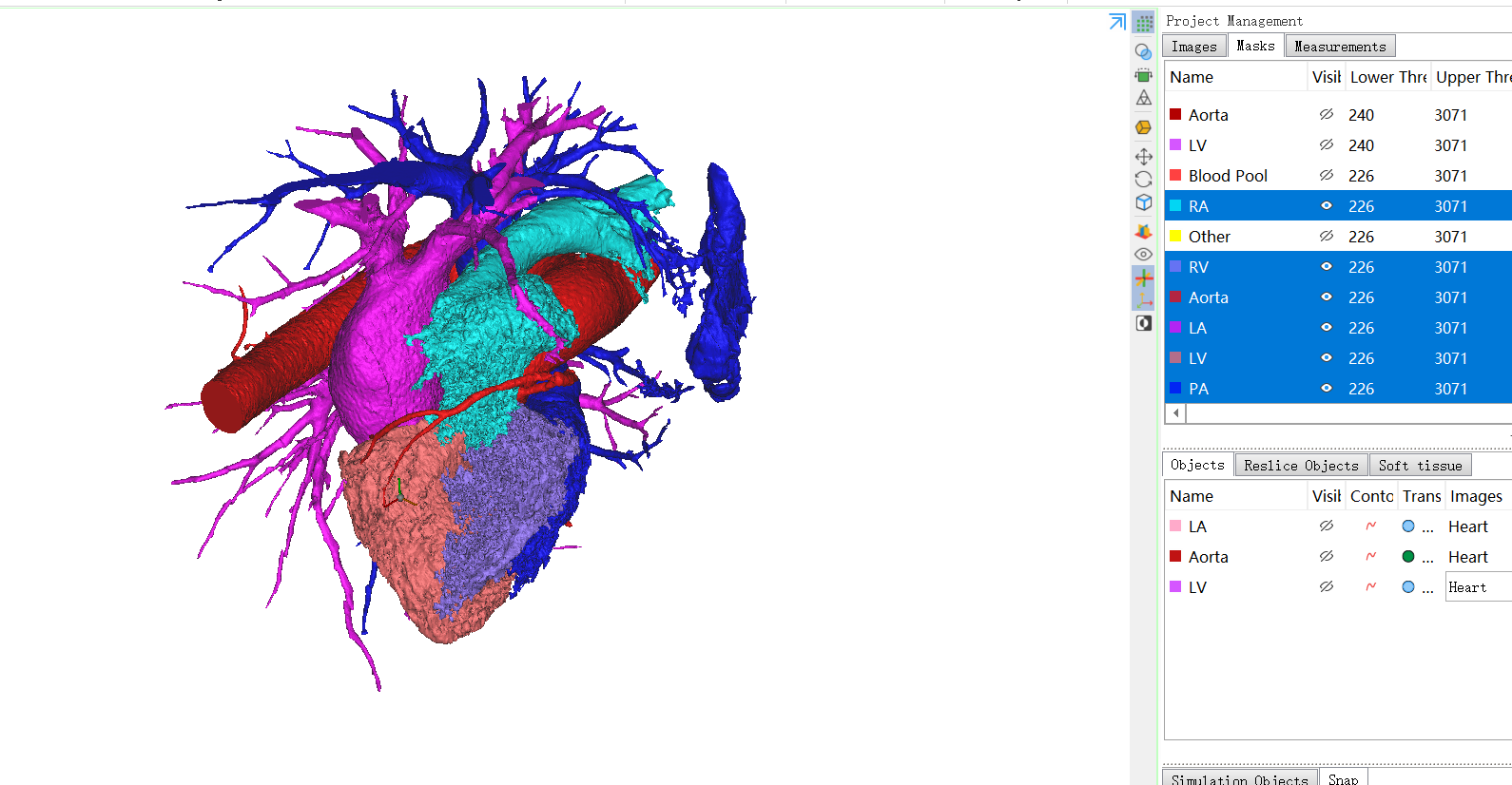 【Mimics】基于心脏ct影像重建3d模型 孔洞修复平滑处理 及 合并导出_ct数据 3d建模-CSDN博客