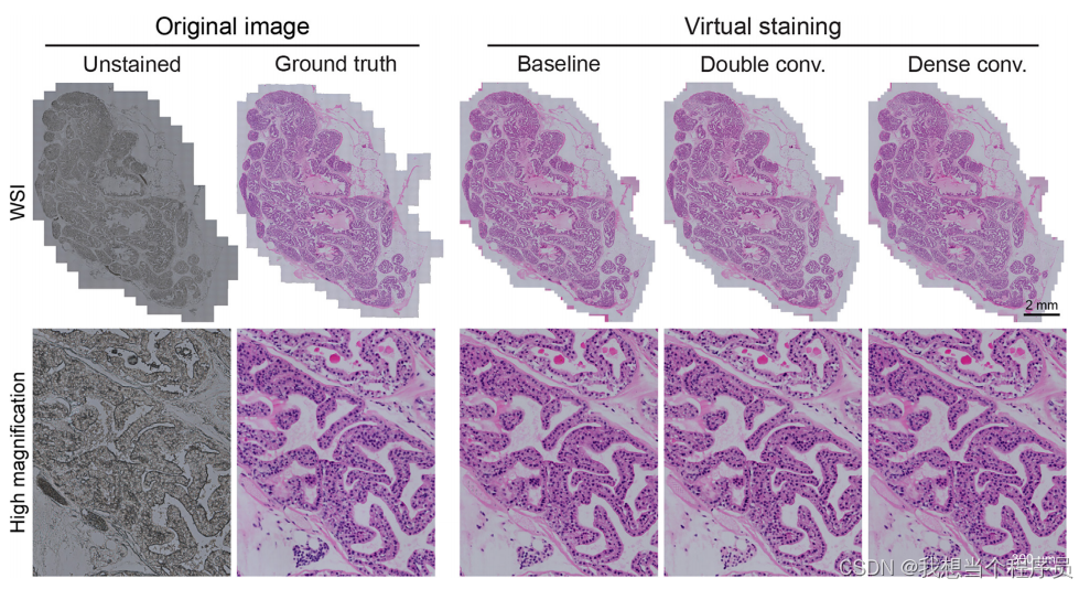 The effect of neural network architecture on virtual H&E staining ...