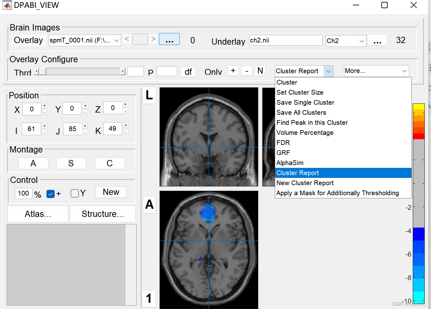 dpabi viewer使用-CSDN博客