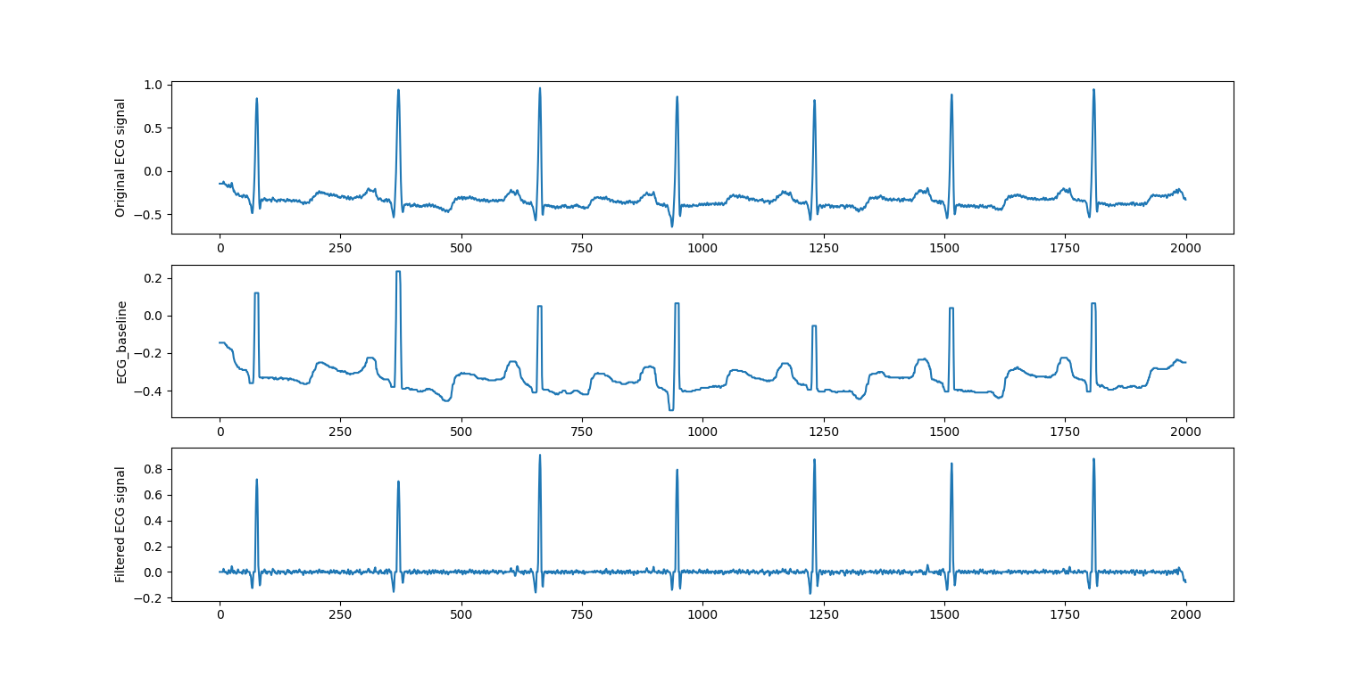 超入门级-基于中值滤波处理ECG信号的基线漂移-Python-MIT-BIH数据集_中值滤波去除基线漂移-CSDN博客