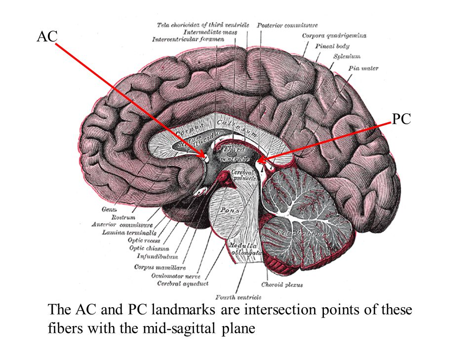 基于主轴变换的医学图像倾斜校正_扫描时机身倾斜与om线平行 mr矫正-CSDN博客