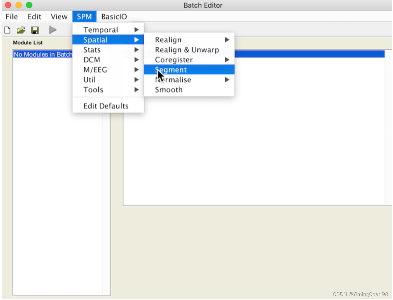 使用Matlab SPM12与MRIcroGL进行头核磁ROI的标准化与Overlap图的制作_YimingChen98的博客-CSDN博客