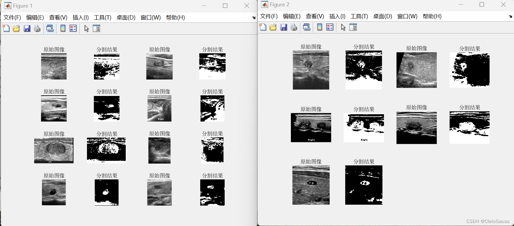 图像分割及其实现过程(matlab篇代码)gac模型代码 Csdn博客