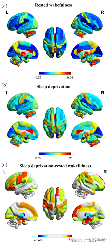 从时间变异性角度看睡眠剥夺后的异常动态功能连接_动态功能连接变异性公式-CSDN博客