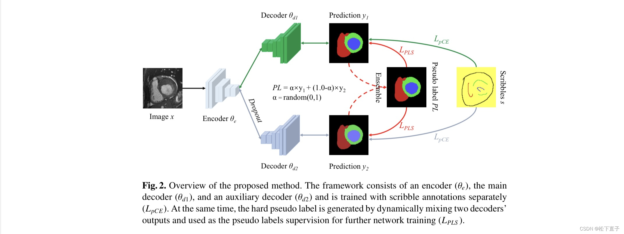 Scribble Supervised Medical Image Segmentation Scribble Supervised Medical Image Segmentation