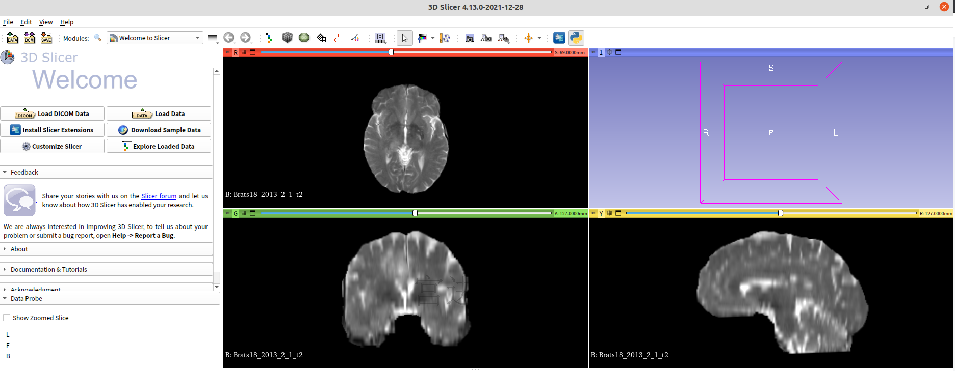 Ubuntu20.04和windows10编译3DSlicer_ubuntu 3d slicer-CSDN博客