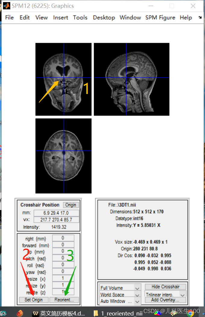 半自动原点矫正_fmri原点矫正-CSDN博客