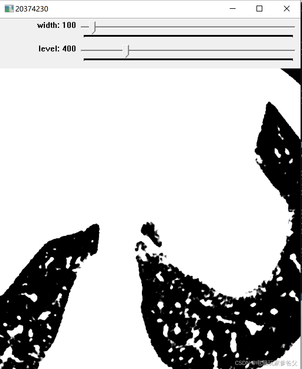 Opencv 实验:实现窗宽窗位调节(附源码及解析)医学影像切片显示与窗宽窗位调节 实验目的 掌握图像矩阵的像素访问方 Csdn博客