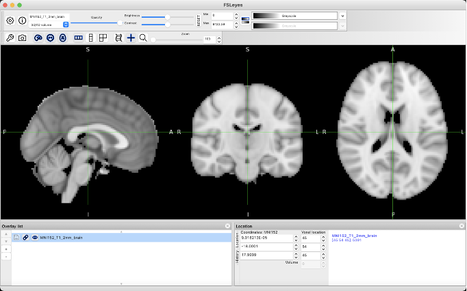 Li‘s 核磁共振影像数据处理-20-FSL数学工具fslmaths_erode by zeroing non-zero voxels ...