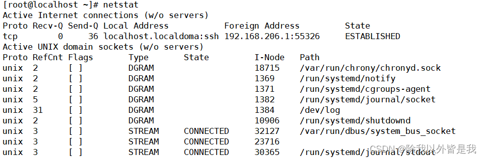 【简单认识linux的网络配置】_linux 怎么看本地localhost-CSDN博客