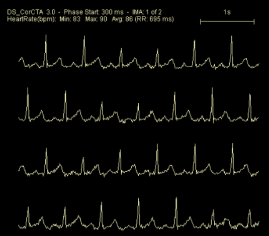 11. DICOM图像显示-DCMTK-overlay覆盖层处理和源码分析_dicom影像浏览器源码-CSDN博客