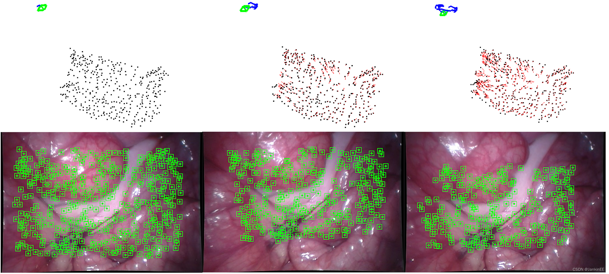 【论文翻译】Tracking monocular camera pose and deformation for SLAM inside the human body_endomapper ...