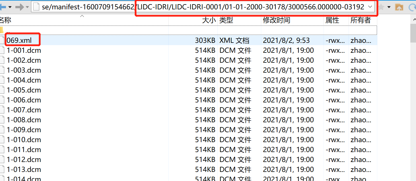 LIDC-IDRI数据集的dicom文件XML标注读取_lidc-idri数据集xml文件注解-CSDN博客