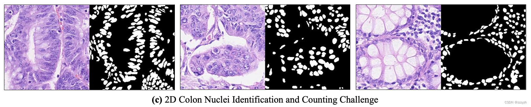 Deep Learning for Medical Image Segmentation: Tricks, Challenges and ...