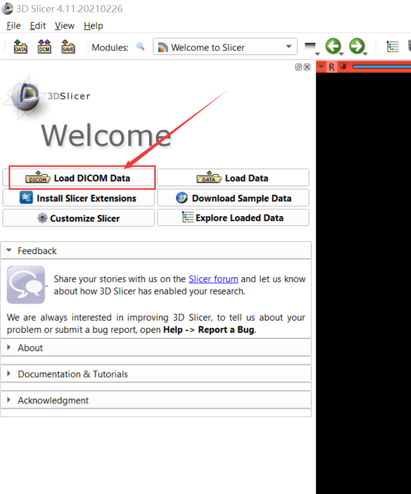 Slicer学习笔记（十九）slicer导入dicom数据_3dslicer 倒序导入dicom-CSDN博客